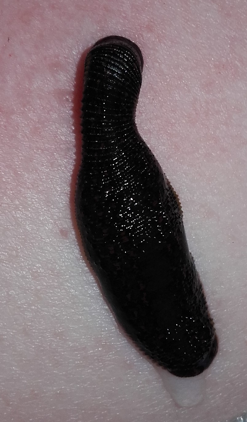 Blutegeltherapie - Naturheilkundepraxis Gabriele Becker